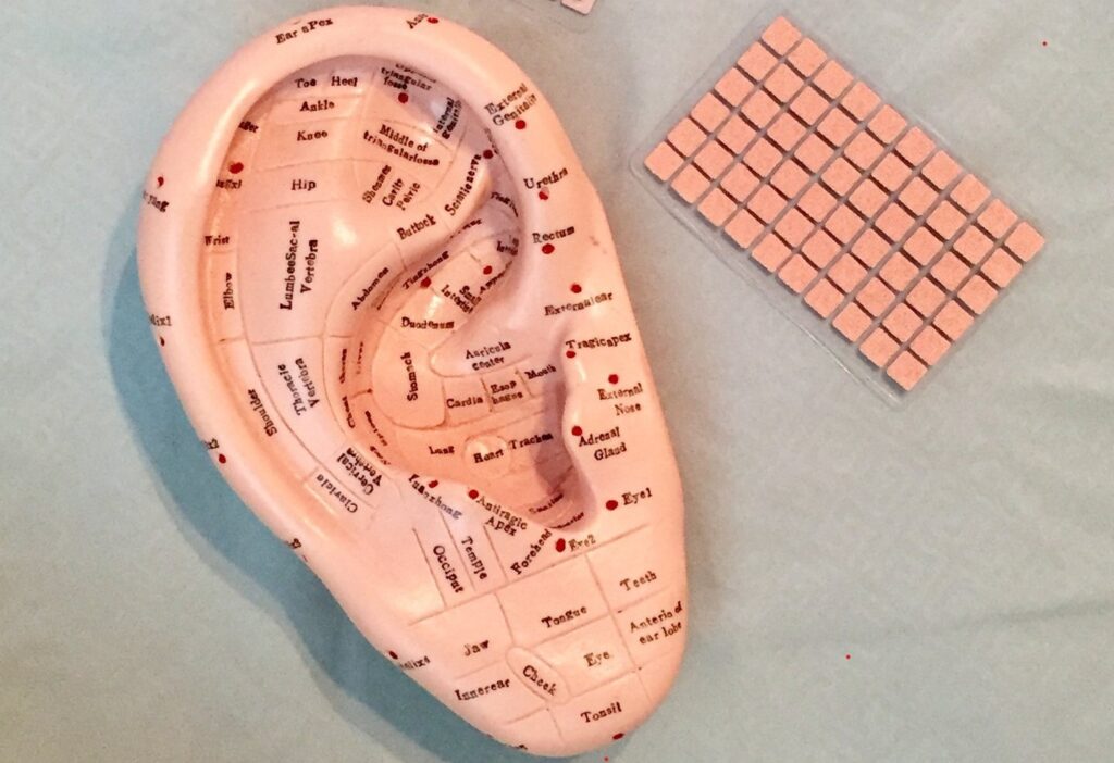 Acupuncture and Herbs for Holistic Healing